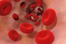 How to Lower Hemoglobin | Healthfully